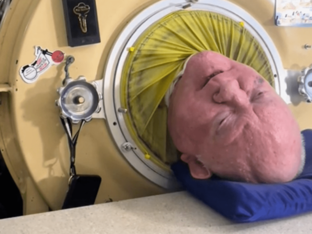 Man Living in the Iron Lung Dies at 78 - Nexus Media